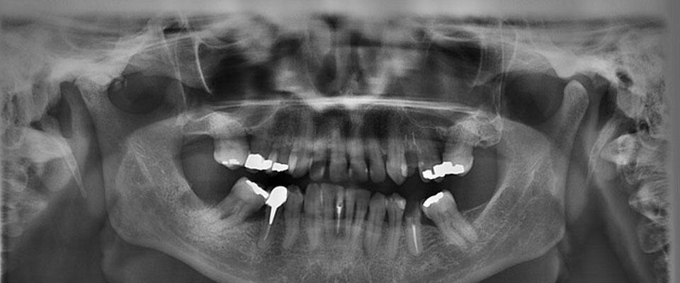 RTG zębów Szczecin: gdzie je wykonać i ile kosztuje?